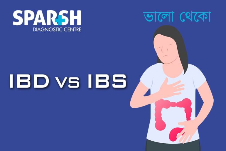 IBS vs IBD: Understanding the Differences, Symptoms, and Treatment ...