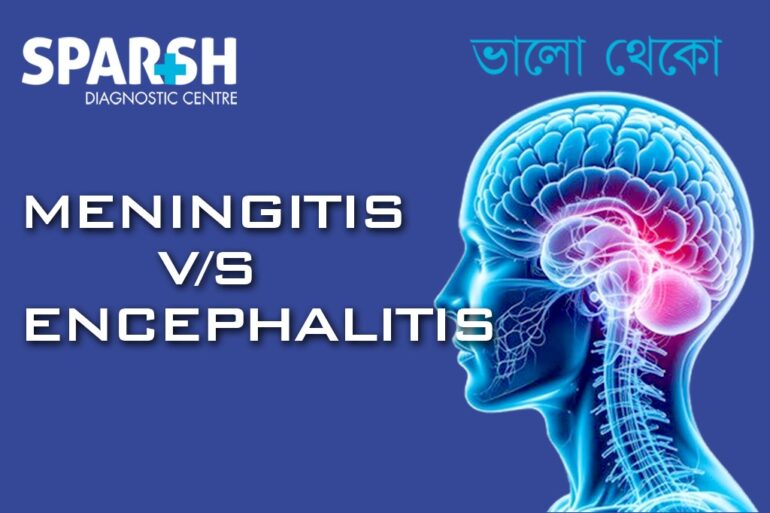 Meningitis vs Encephalitis - Sparsh Diagnostic Center