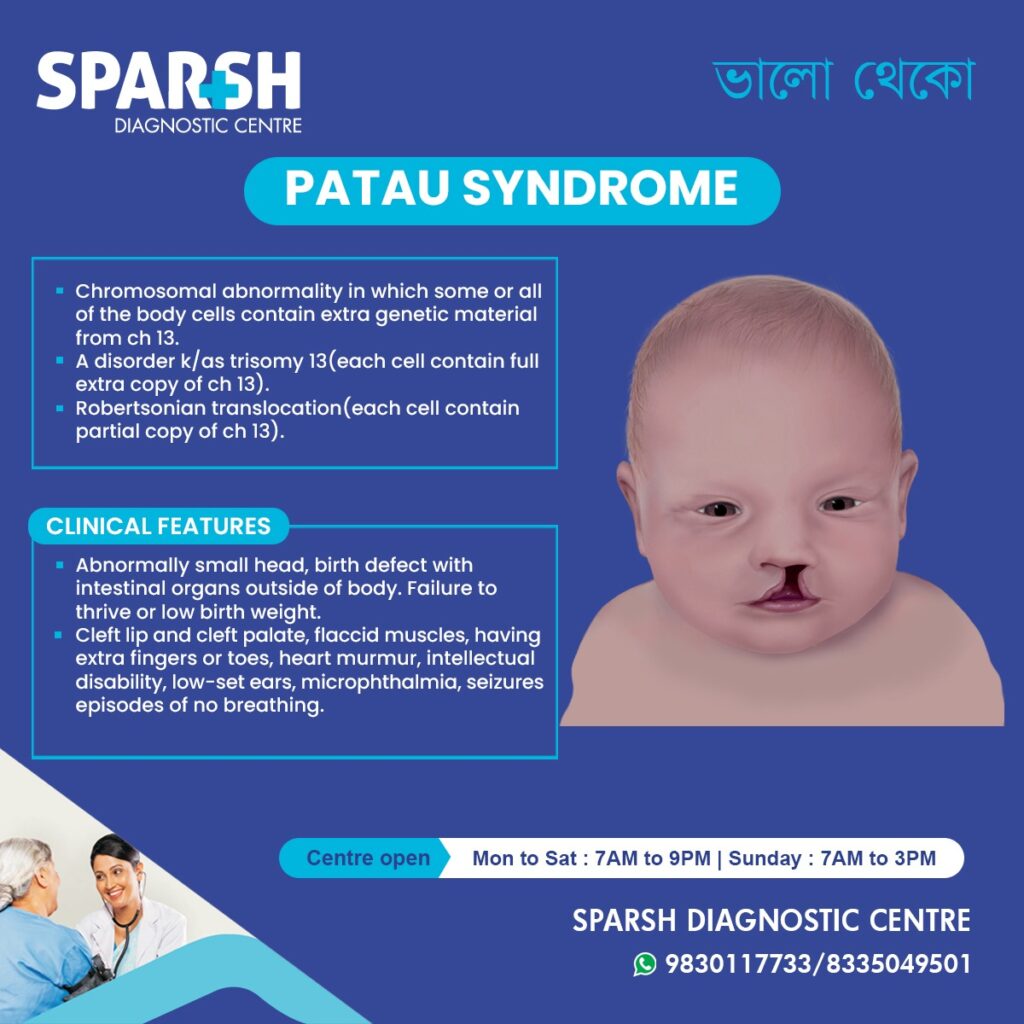 Patau Syndrome (Trisomy 13) - Sparsh Diagnostic Center
