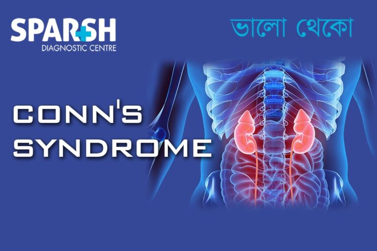 Conn’s Syndrome (Primary Hyperaldosteronism) - Sparsh Diagnostic Center