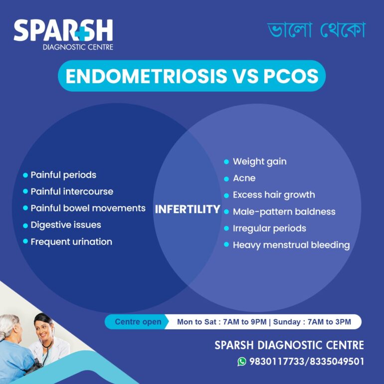 Endometriosis vs PCOS - Sparsh Diagnostic Center