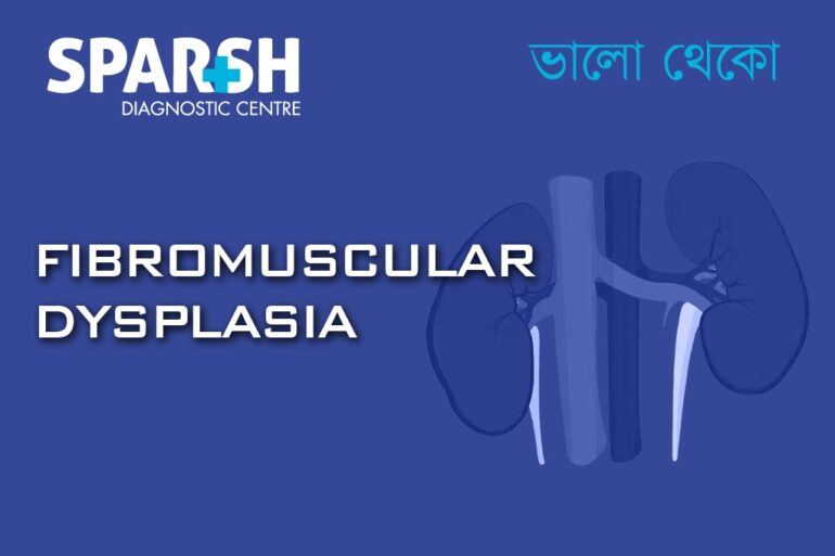 Fibromuscular Dysplasia (FMD) - Sparsh Diagnostic Center