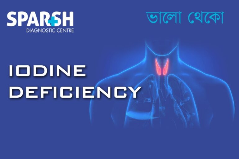 Iodine Deficiency - Sparsh Diagnostic Center