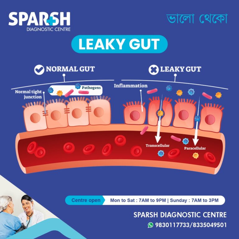 Leaky Gut - Sparsh Diagnostic Center