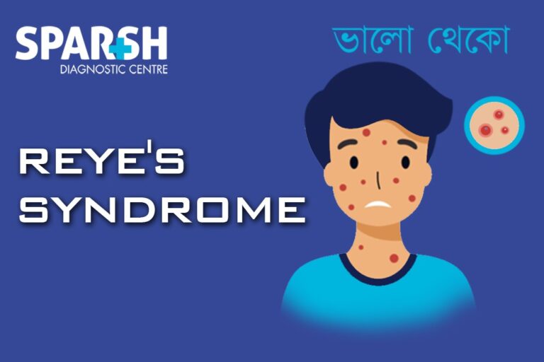 Reye's Syndrome - Sparsh Diagnostic Center