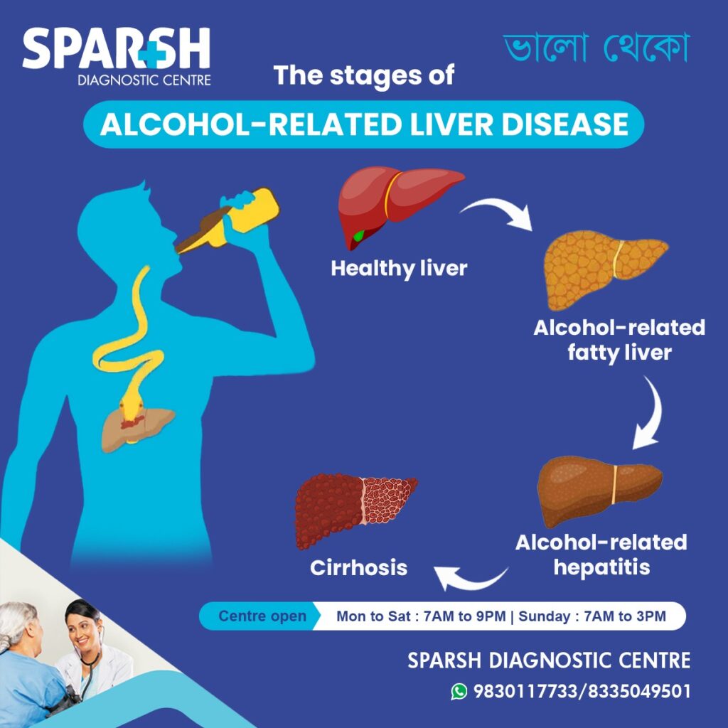 Alcohol-Related Liver Disease (ARLD) - Sparsh Diagnostic Center