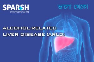 Alcohol-Related Liver Disease (ARLD) - Sparsh Diagnostic Center