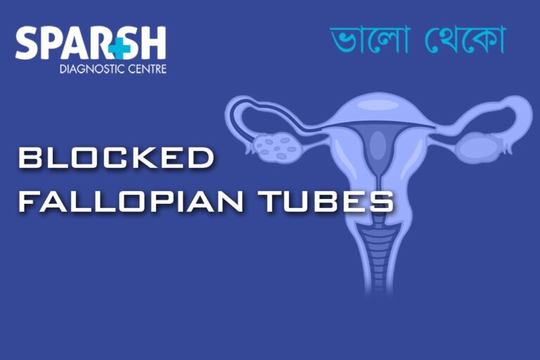 Blocked Fallopian Tubes - Sparsh Diagnostic Center