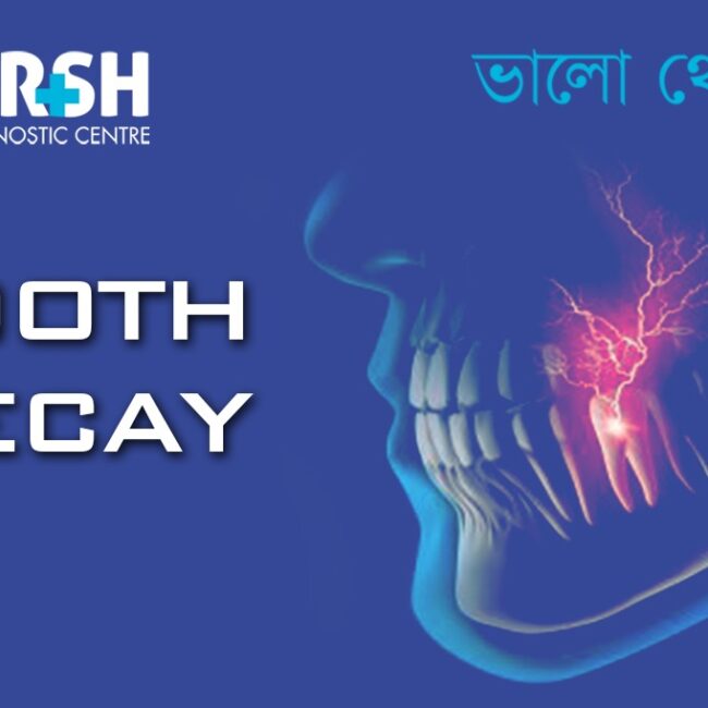 Throat Cancer - Sparsh Diagnostic Center