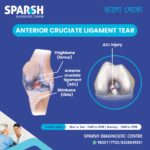 ACL Tear - Sparsh Diagnostic Center