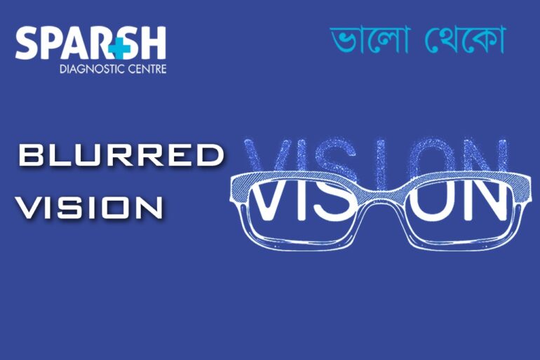 Blurred Vision - Sparsh Diagnostic Center