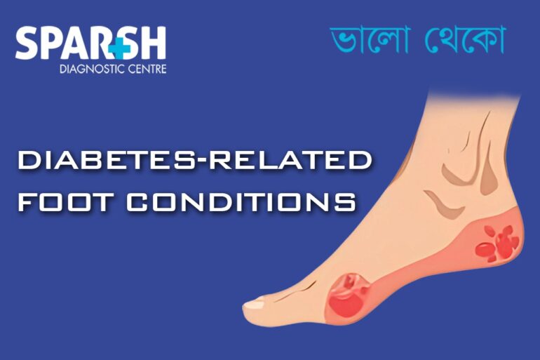 Diabetes-Related Foot Conditions - Sparsh Diagnostic Center