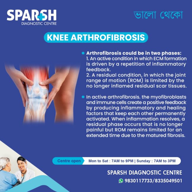 Knee Arthrofibrosis - Sparsh Diagnostic Center