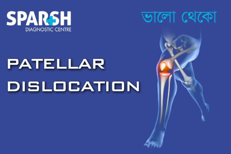 Patellar Dislocation Sparsh Diagnostic Center 9219