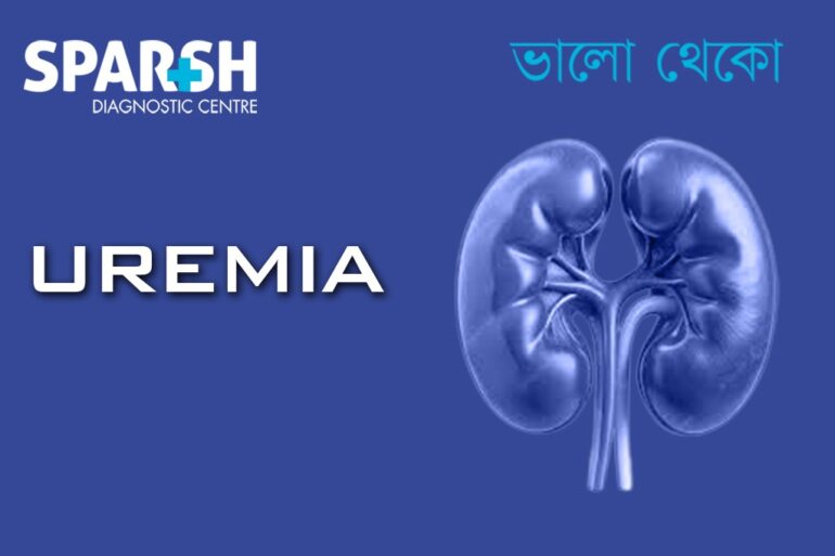 Uremia - Sparsh Diagnostic Center