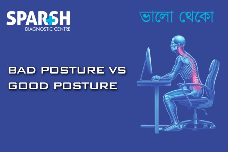 Good Posture vs Bad Posture - Sparsh Diagnostic Center