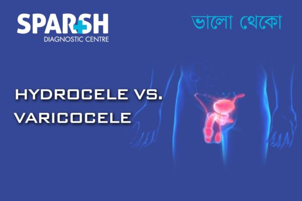 Hydrocele vs Varicocele - Sparsh Diagnostic Center
