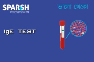 IgE Test - Sparsh Diagnostic Center