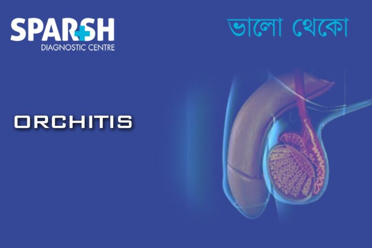 Orchitis - Sparsh Diagnostic Center