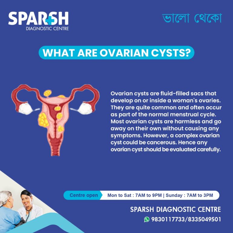 Ovarian Cysts - Sparsh Diagnostic Center