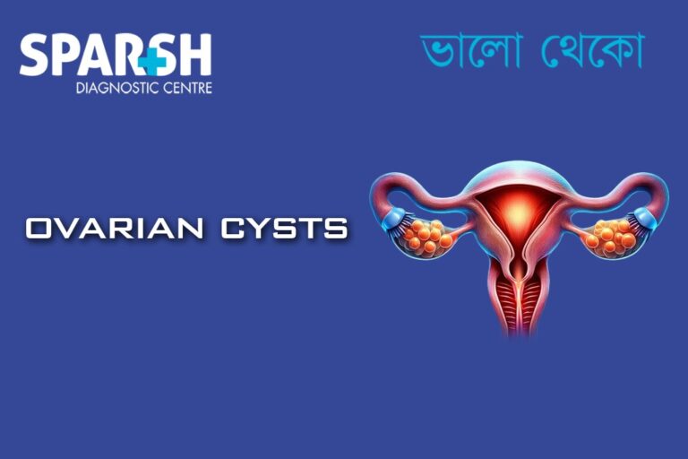 Ovarian Cysts - Sparsh Diagnostic Center