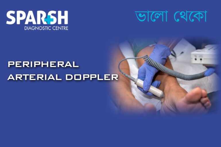 Peripheral Arterial Doppler: Diagnosing PAD Without Invasive Surgery ...