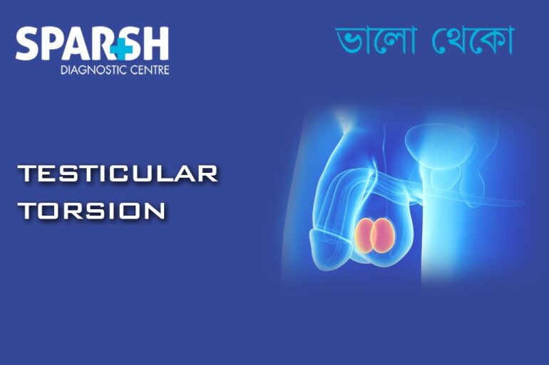 Testicular Torsion - Sparsh Diagnostic Center