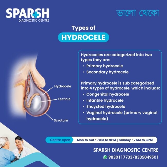 Hydrocele - Sparsh Diagnostic Center
