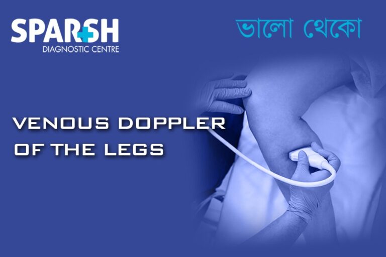 Venous Doppler of the Legs: A Key Test for DVT (Deep Vein Thrombosis ...