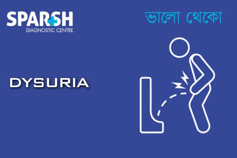 Dysuria - Sparsh Diagnostic Center