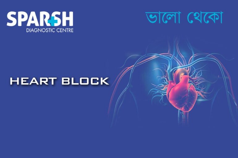 Heart Block - Sparsh Diagnostic Center