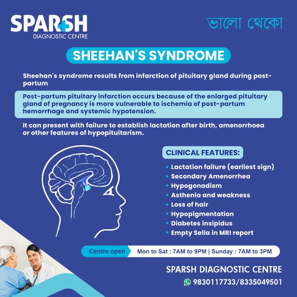 Sheehan's Syndrome - Sparsh Diagnostic Center