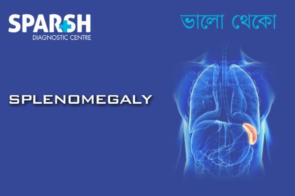 Splenomegaly (Enlarged Spleen) - Sparsh Diagnostic Center