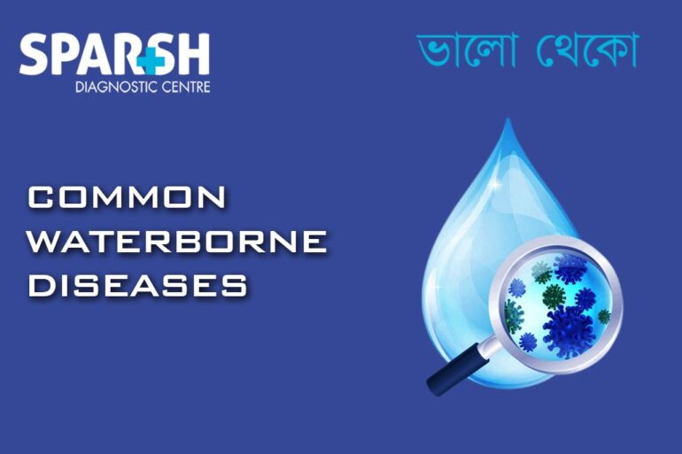 Common Waterborne Diseases - Sparsh Diagnostic Center