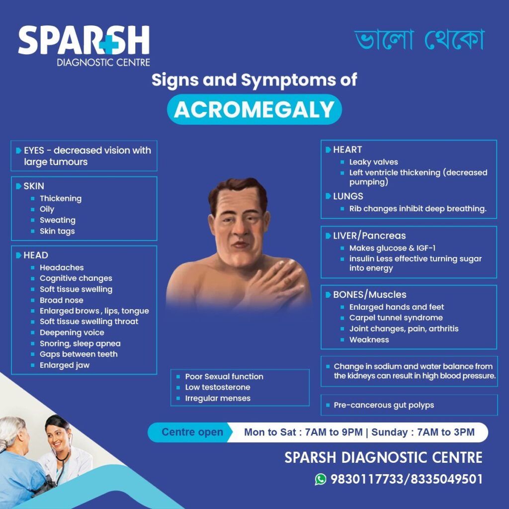 Acromegaly: Causes, Symptoms, Diagnosis, and Treatment - Sparsh ...