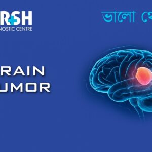 Knee Ligaments: Anatomy, Injuries, and Treatment - Sparsh Diagnostic Center