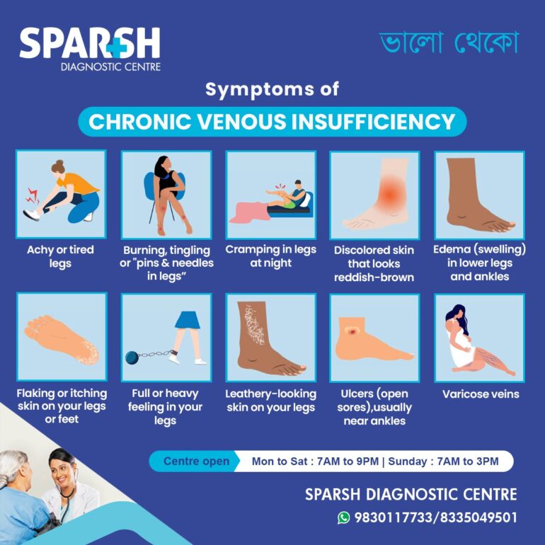 Chronic Venous Insufficiency: Causes, Symptoms, Diagnosis, and ...