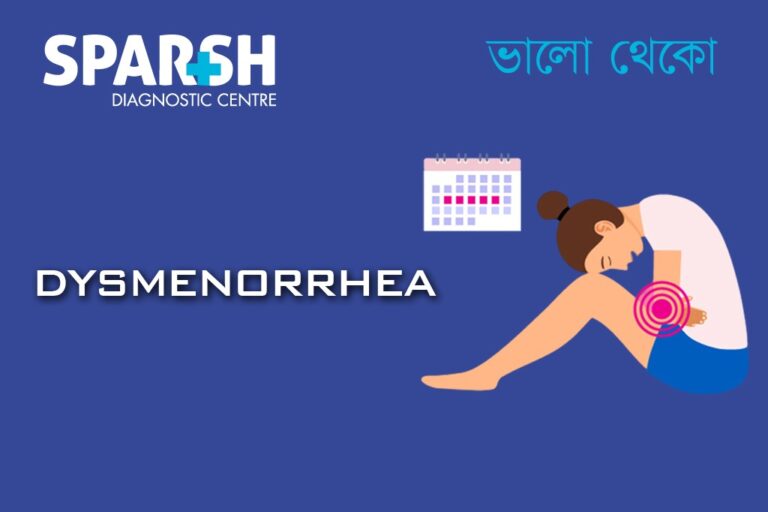Dysmenorrhea: Causes, Symptoms, Treatment, and Relief Options - Sparsh ...