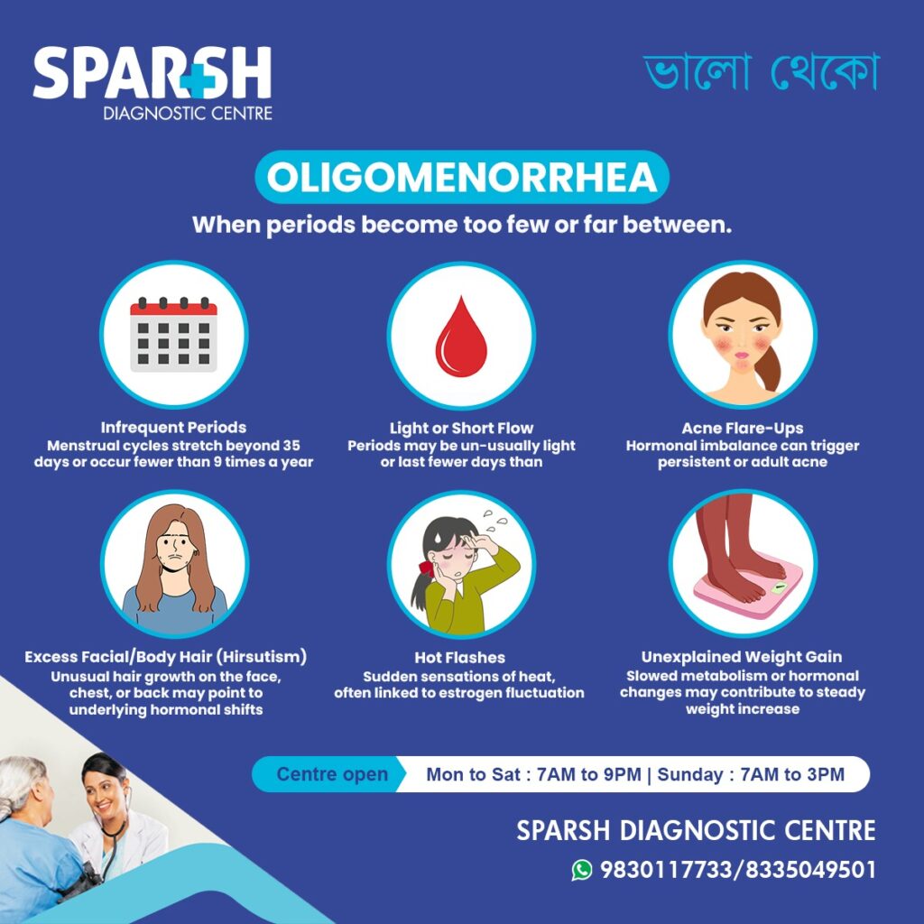 Oligomenorrhea: Causes, Symptoms, Diagnosis, and Treatment - Sparsh ...