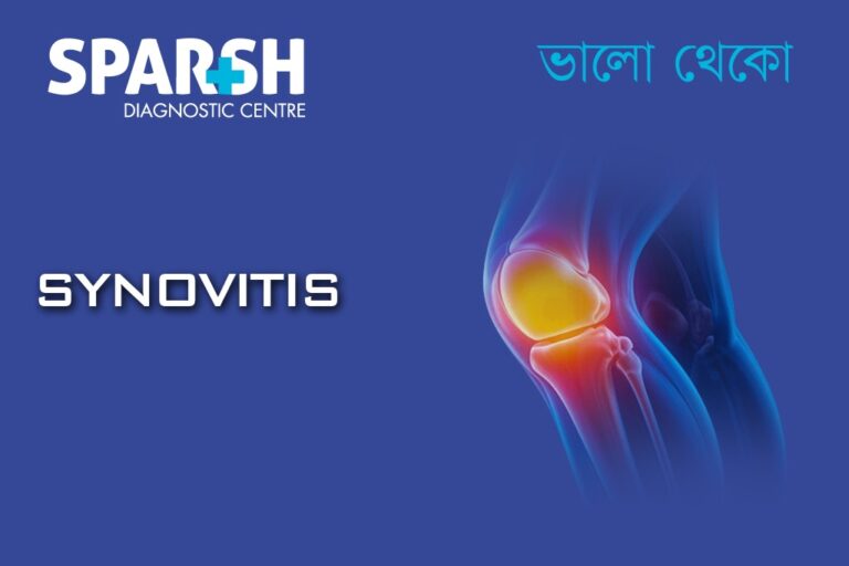 Synovitis: Causes, Symptoms, Diagnosis, and Treatment - Sparsh ...