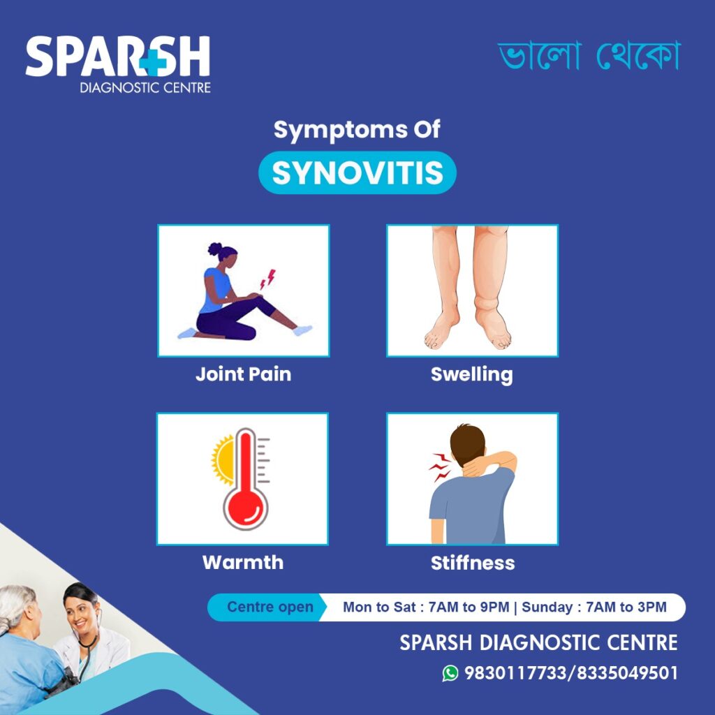 Synovitis: Causes, Symptoms, Diagnosis, and Treatment - Sparsh ...