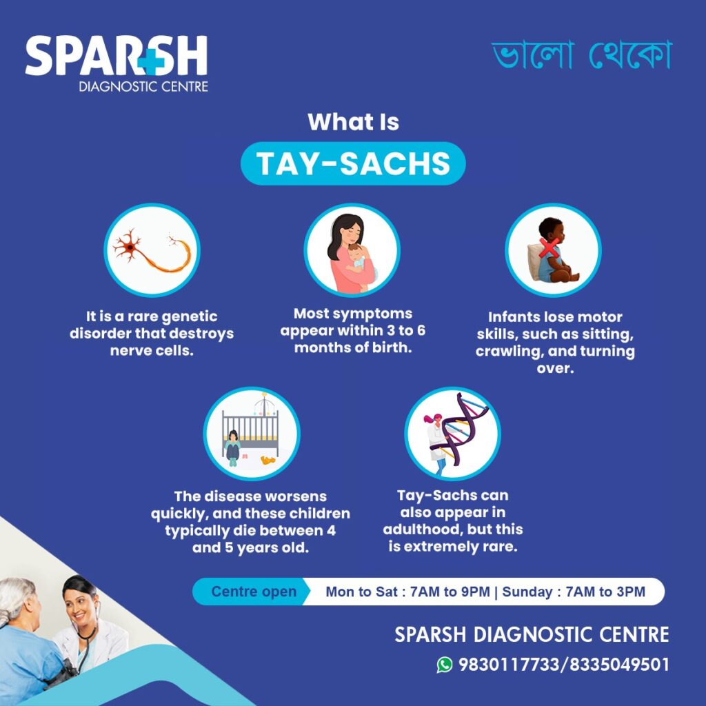 Tay-Sachs Disease: Causes, Symptoms, Diagnosis, and Treatment - Sparsh ...