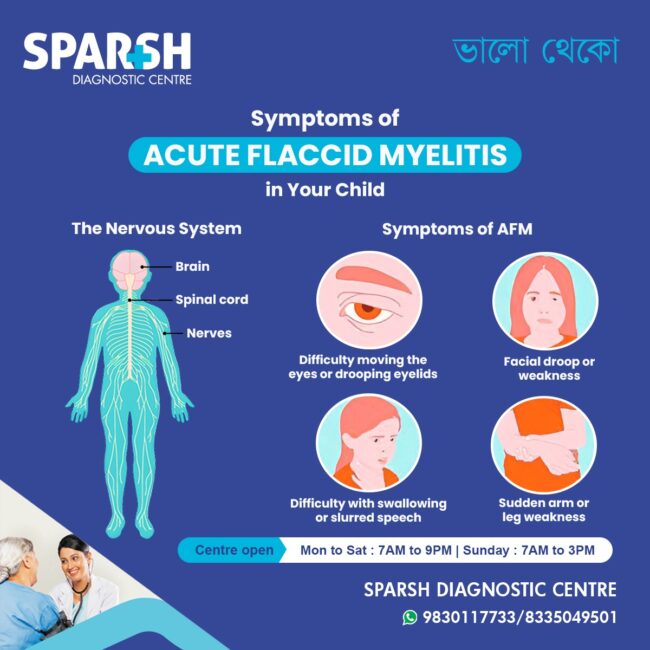 Acute Flaccid Myelitis (AFM): Symptoms, Causes, Diagnosis, and ...