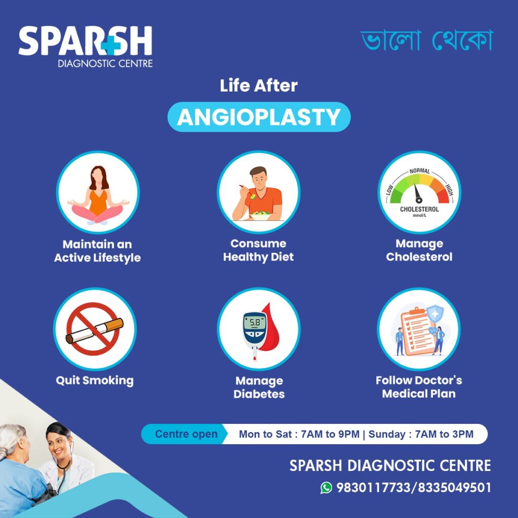 Angioplasty: Procedure, Recovery, and Life After Treatment - Sparsh ...