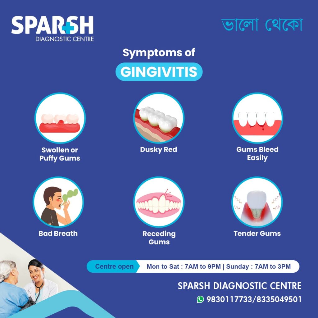 Gingivitis: Causes, Symptoms, Diagnosis, and Treatment - Sparsh ...