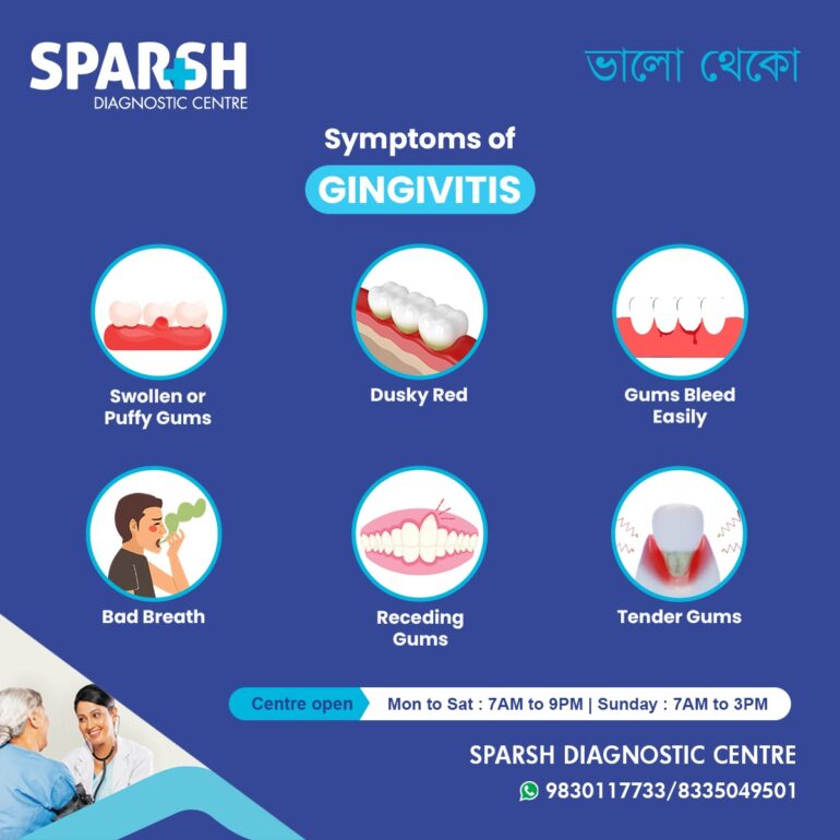 Gingivitis: Causes, Symptoms, Diagnosis, and Treatment - Sparsh ...