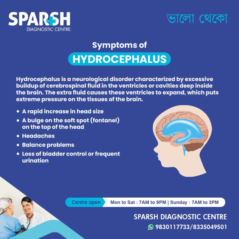 Hydrocephalus: Causes, Symptoms, Diagnosis, and Treatment - Sparsh ...