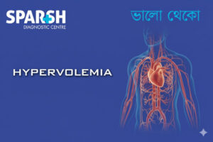 Hypervolemia: Causes, Symptoms, Diagnosis, and Treatment - Sparsh ...