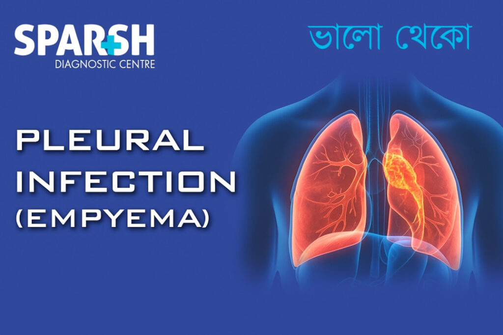 Pleural Infection (Empyema): Causes, Symptoms, Diagnosis, and Treatment ...