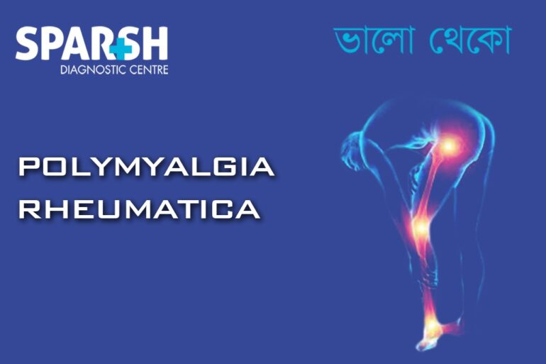 Polymyalgia Rheumatica: Symptoms, Causes, Diagnosis, and Treatment ...
